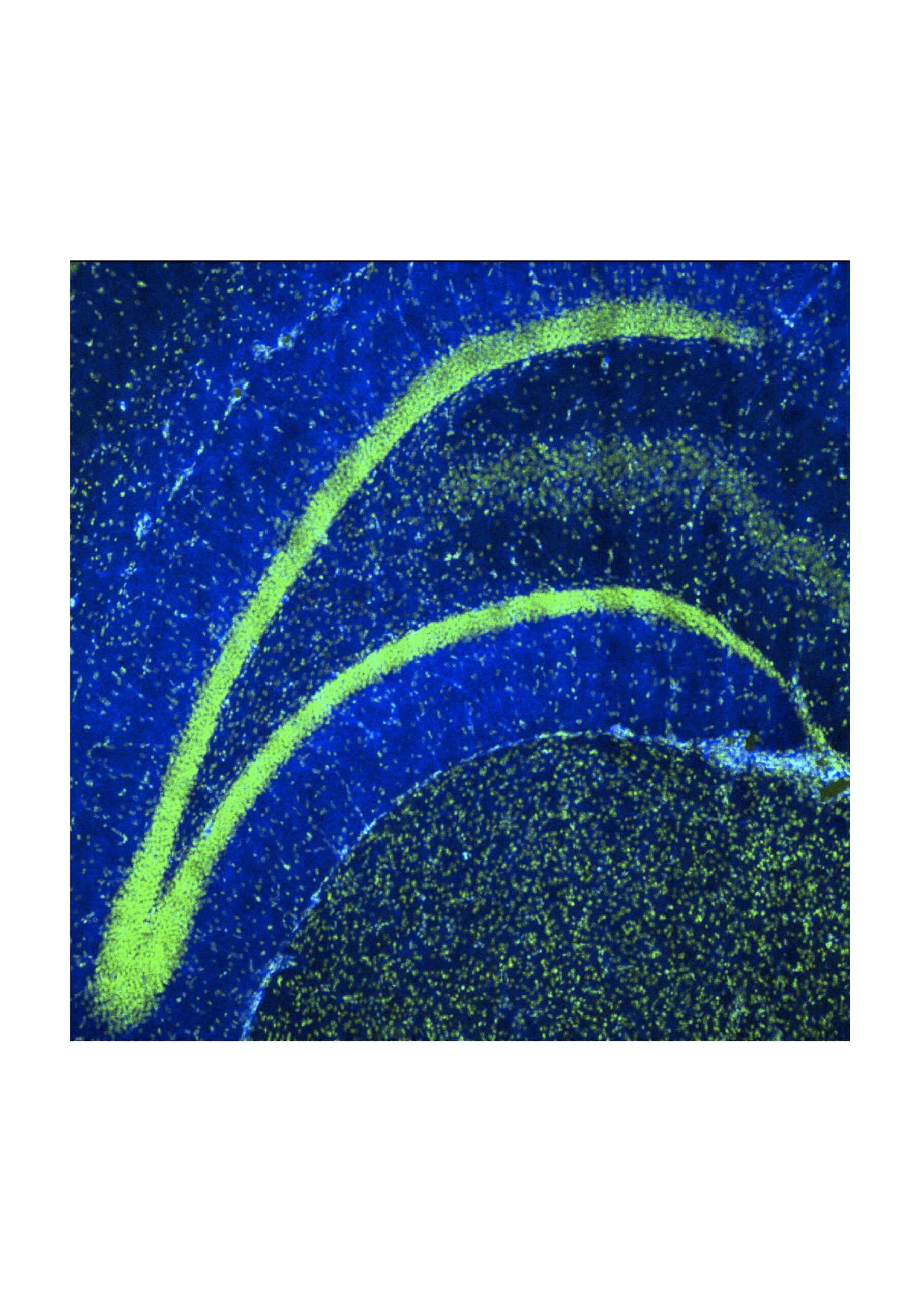 Projets en cours - Centre de Référence des Maladies Mitochondriales Sud ...